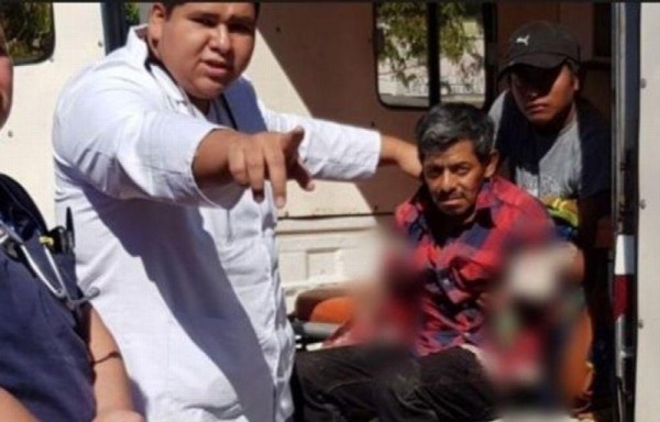 Por curiosidad perdió sus dos brazos