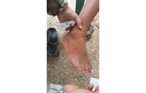 Senan socorre a menor picado por mantarraya